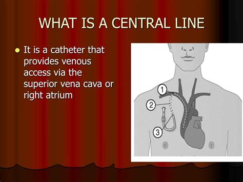 Ppt Central Lines And Arterial Lines Powerpoint Presentation Free Download Id 5731044
