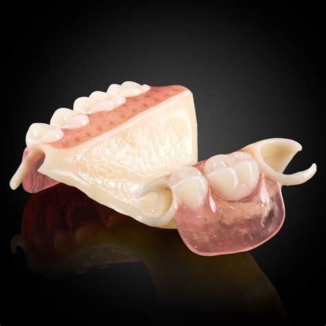 Acetal Framework Partial Denture Xdent Lab