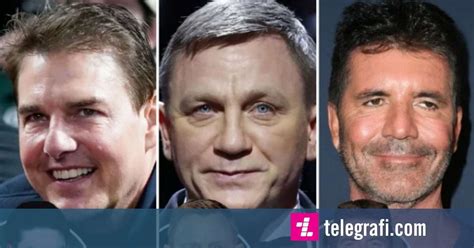 Male Celebrities With Plastic Surgery 60 Photos Moonagedaydream Film