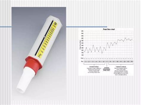 Spirometry Ppt