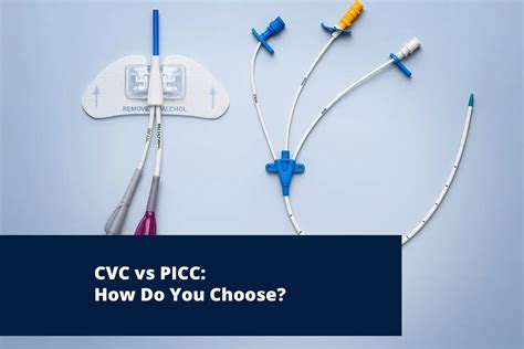 Picc Vs Cvc Catheters Buyers Guide Key Differences Use Cases And Tips