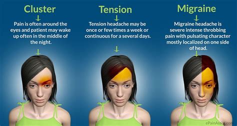 Pin On Migraines And Headaches