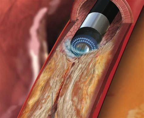 Articles Market News Idata Research