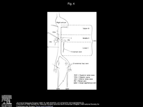 Primary Venous Leiomyosarcoma A Rare But Lethal Disease Ppt Download