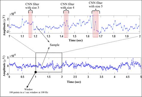 Automated Classification System For Drowsiness Detection Using Convolutional Neural Network And