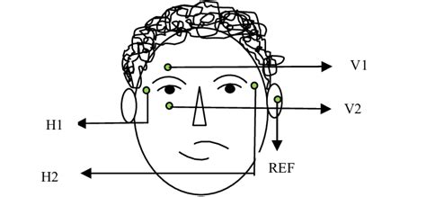 Electrode Placement For Eog Acquisition Download Scientific Diagram