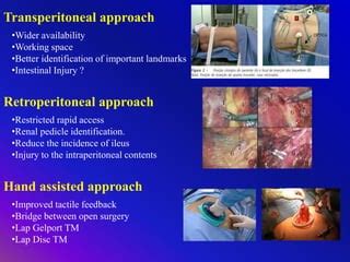 Laparoscopic Urological Surgery Pptx
