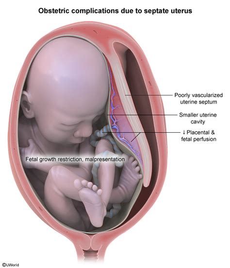 Fetal Malpresentation Obstetrics Uworld Medical Library