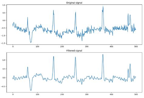 Rhythmi A Deep Learning Based Mobile Ecg Device For Heart Disease Prediction