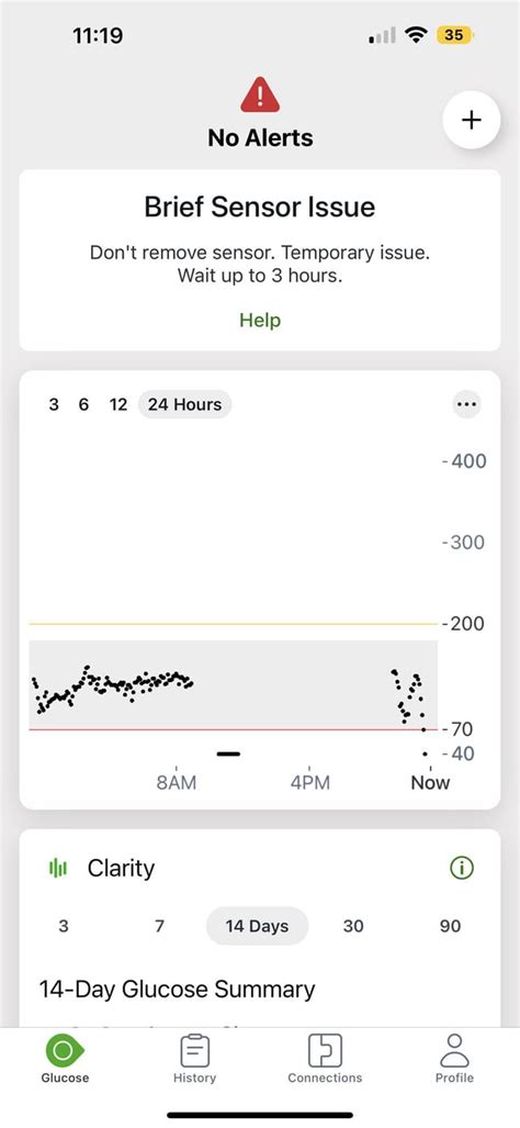 Sensor Error Rdexcom