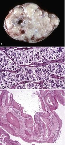Sys Path Male Repro Pics Flashcards Quizlet