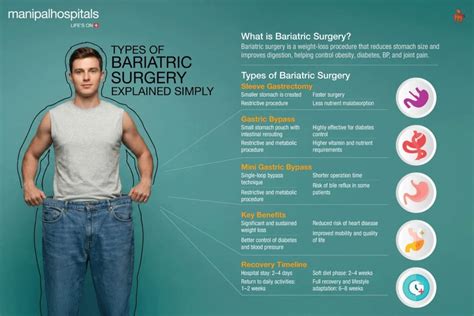 Bariatric Surgery Overseas Guide Cost Benefits And Recovery