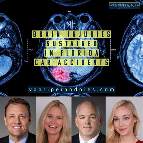 Brain Injuries Sustained In Florida Car Accidents Van Riper And Nies Attorneys