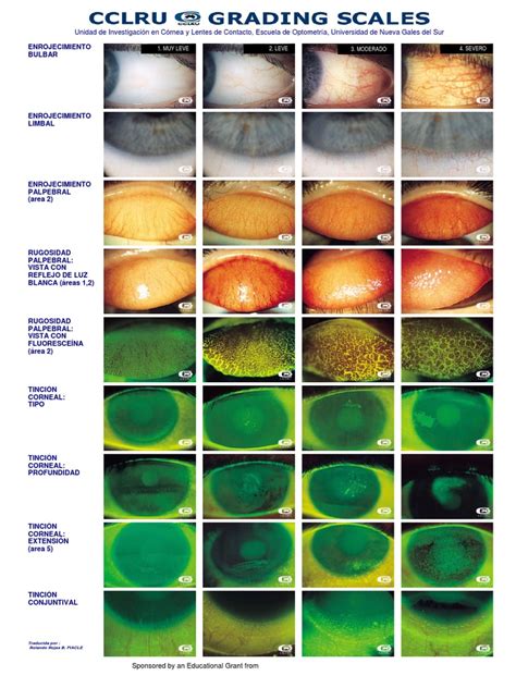 Escala Cclru Traduccion Descargar Gratis Pdf Inflamación Córnea