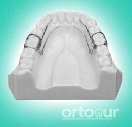 Bihelix Componentes Indicaciones Y Contraindicaciones Ortomur