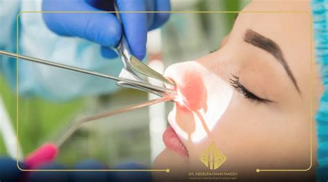 Nasal And Sinus Endoscopy Drabdelrahman Magdy