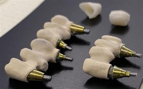 Dio Implants Artdentis