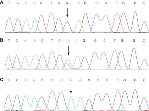 Sequencing Map Of Genotype For Il 27 Rs153109 Polymorphism Notes The