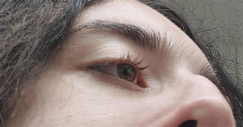 Teeth Album On Imgur