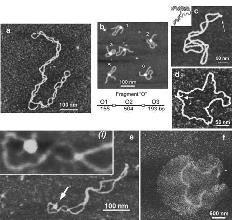 Visualization Of Dna And Protein Dna Complexes With Atomic Force Microscopy Radiology Key