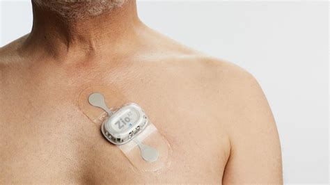 What Is Zio Xt Heart Monitor At Jonathan Baylee Blog
