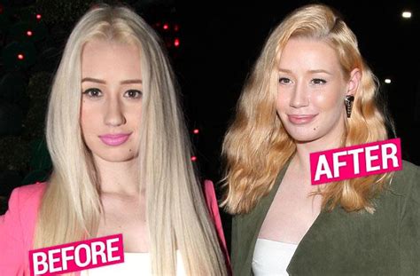 Iggy Azalea Before Implants