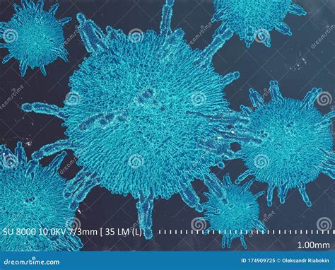 Virus Under The Microscope Stock Illustration Illustration Of China 174909725