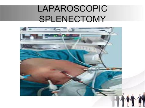 Spleenectomy Ppt