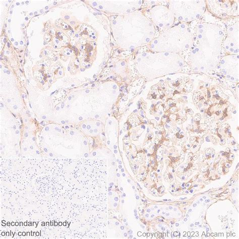 Pdgfr Beta抗体 Epr26830 84 Ab313777 Abcam中文官网