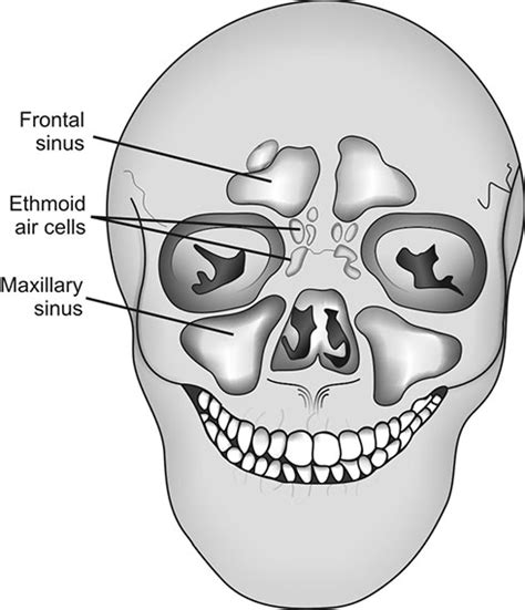 Maxillary Sinus Skull