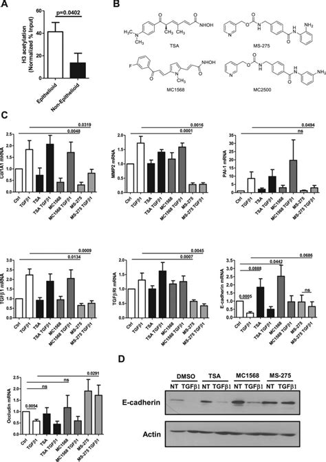 Effect Of Class I And Class Ii Hdac Inhibition On Epithelial And Download Scientific Diagram