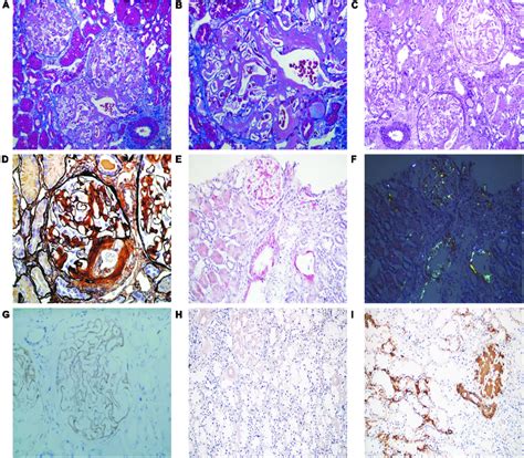 Pathological Features Of Light Microscopy And Immunohistochemistry