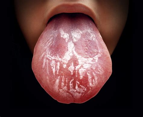 Oral Sex Safety Protecting Yourself From Stds