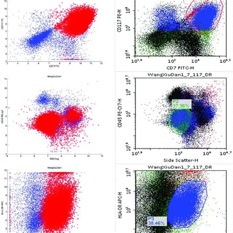 Comparison Of The Automatic Svm And Manual Analyses Of Typical Aml Download Scientific Diagram