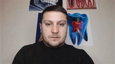 виды виниров Youtube