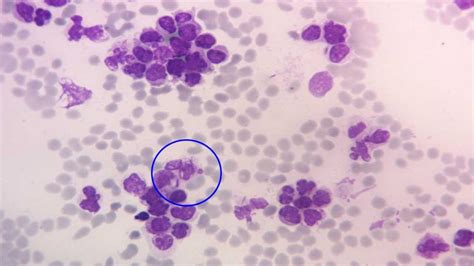 May Grünwald Giemsa Or Mgg Stain Principle And Procedure