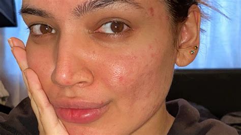Model And Activist Kadeeja Khan On Acne Beauty And Self Love British Vogue