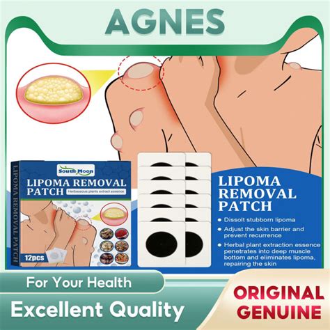 【hot Sale】south Moon Lipoma Lumps Removal Patch Herbal Deep Penetration Lymphatic Drainage Patch