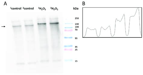A Identification Of Mda Protein Adducts In Homogenates Of Porcine Download Scientific Diagram