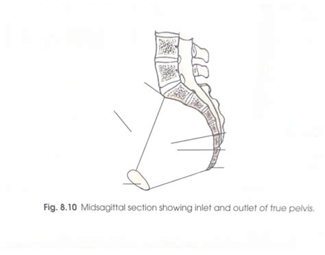 Midsagittal Section Of True Pelvis Quiz