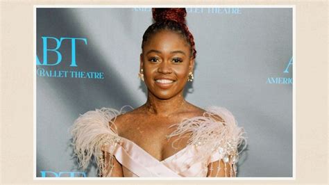 Actress With Vitiligo 60 Photos Moonagedaydreamfilm