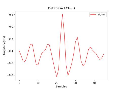 ecg signal segmentation a searching r peaks b fix length