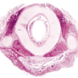 Horizontal Section Through Cricoid Cartilage Hematoxylin And Eosin