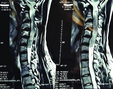 Pre Op Magnetic Resonance Imaging Mri Download Scientific Diagram