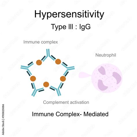 The Diagram Of Hypersensitivity Type Lll Immune Complex Mediated That Shows The Immune
