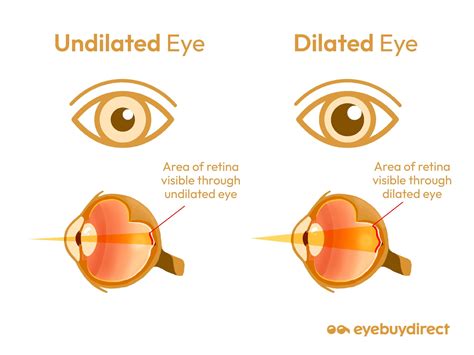 How Long Does Pupil Dilation Last Blog Eyebuydirect