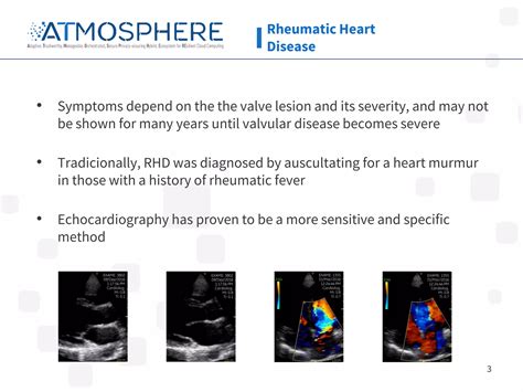 Diagnosis Assistance For Rheumatic Heart Disease By Extracting Features