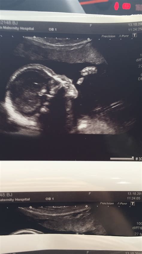 Skull Theory For Gender Prediction