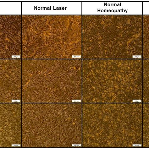 Shown Is The Morphology Of Normal Cell Models Treatment With Laser Download Scientific Diagram