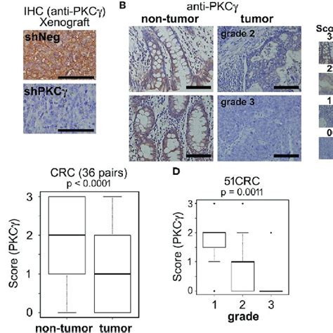Pkcg Expression Is Lower In Dedifferentiated Crcs A Positive Control